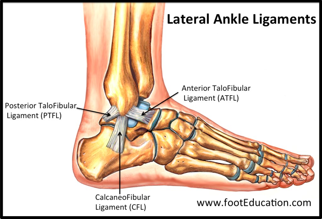 Lateral Ankle Sprain: How to treat it